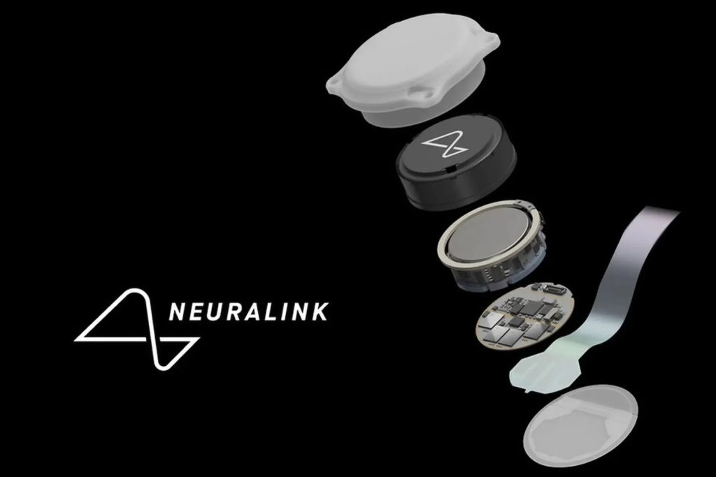 Elon Musk's Neuralink performs first human brain implant - Tech Guide